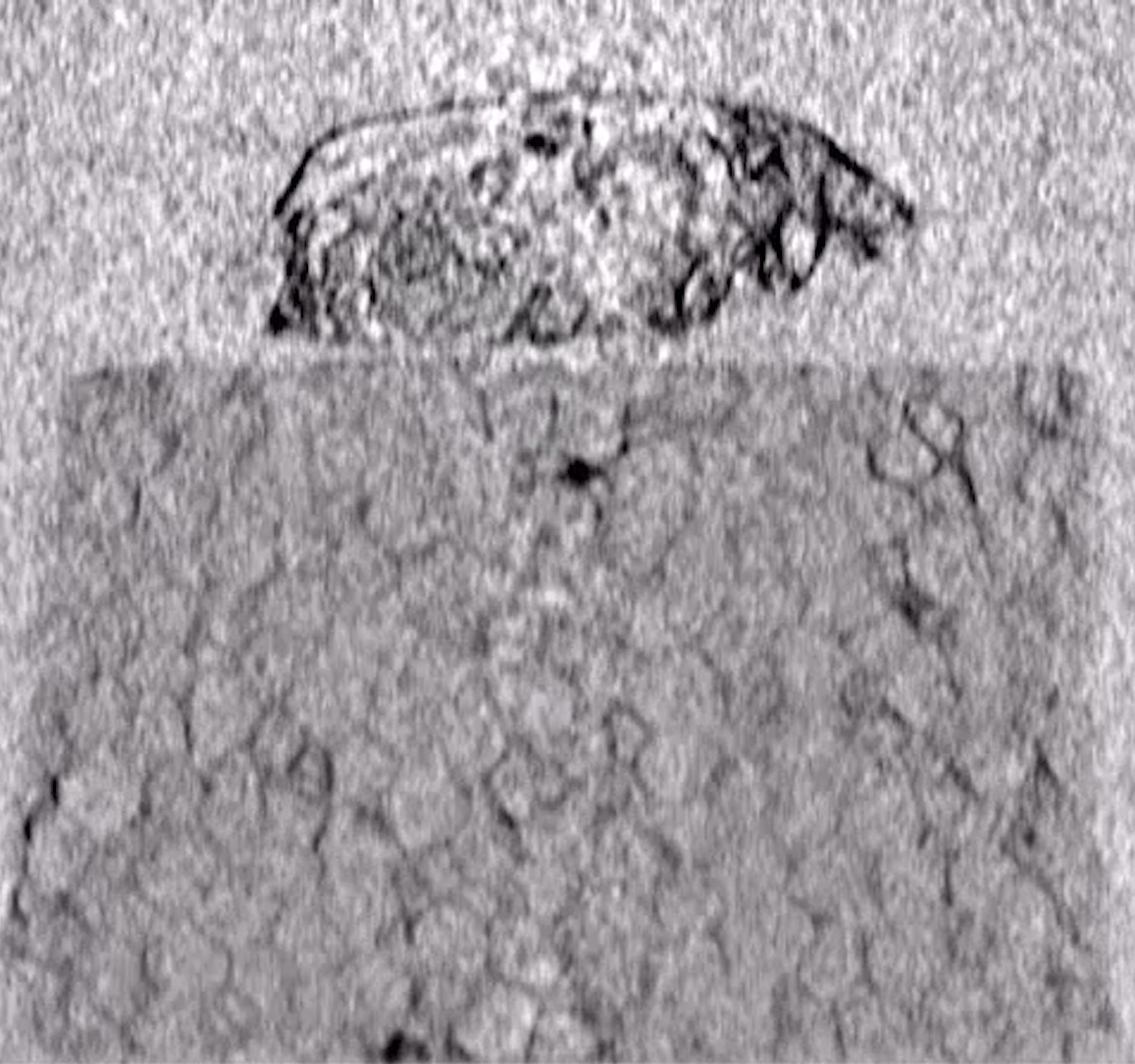 X-Ray Phase Contrast Imaging – Microsystems Engineering, Science and ...